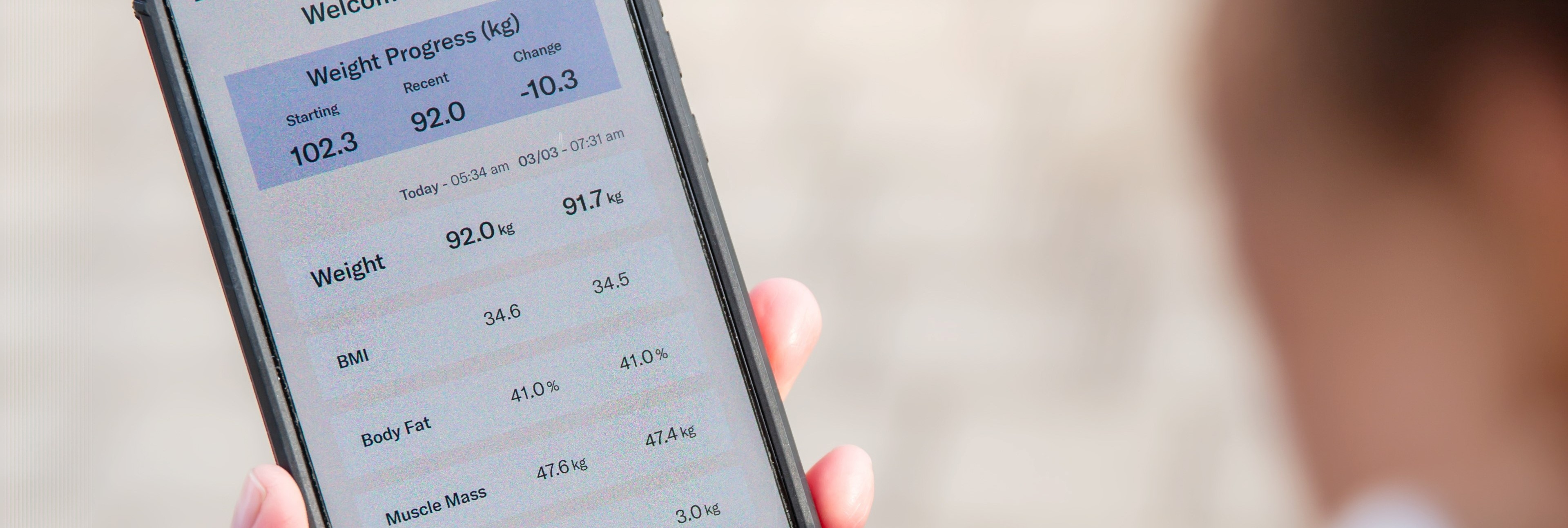 Allurion Announces NYSE Acceptance of Plan to Regain Listing Compliance ...